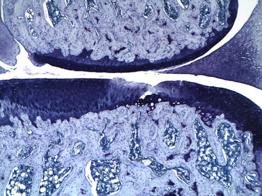 Destabilization of the Medial Meniscus (DMM) in Rats & Mice
