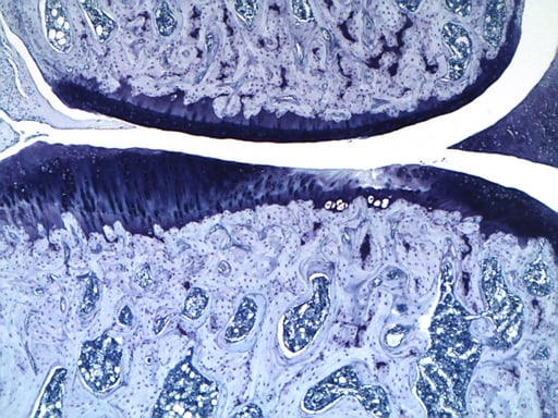 Destabilization of the Medial Meniscus (DMM) in Rats & Mice