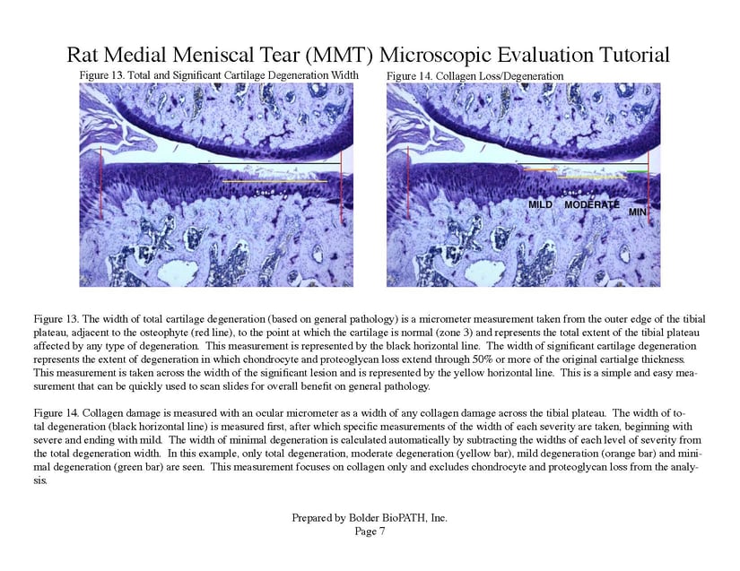 Medial Meniscal Tear-Induced OA (MMT) in Rats