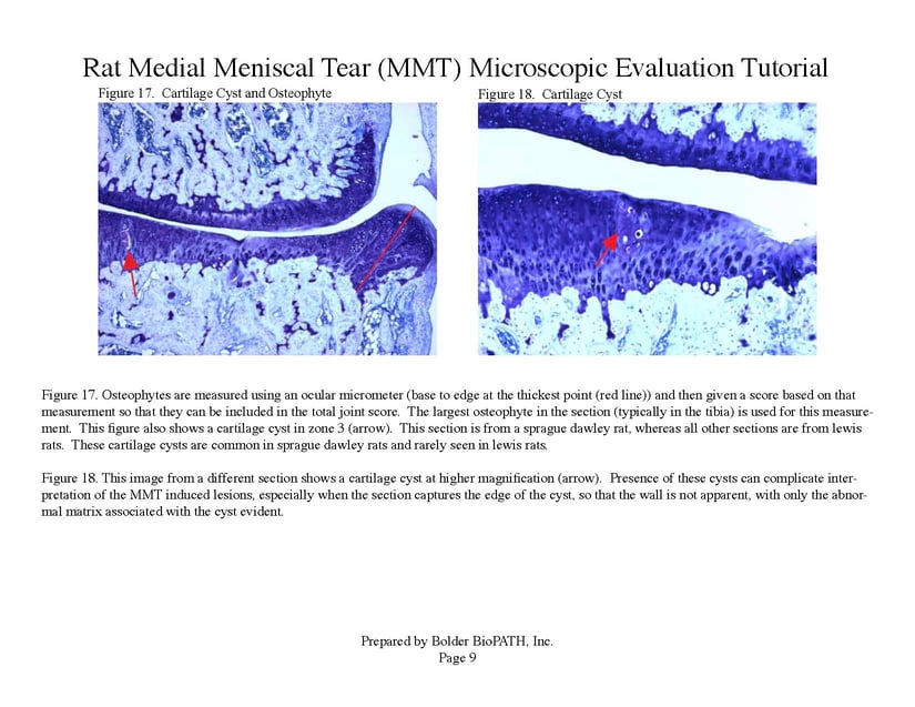 Medial Meniscal Tear-Induced OA (MMT) in Rats
